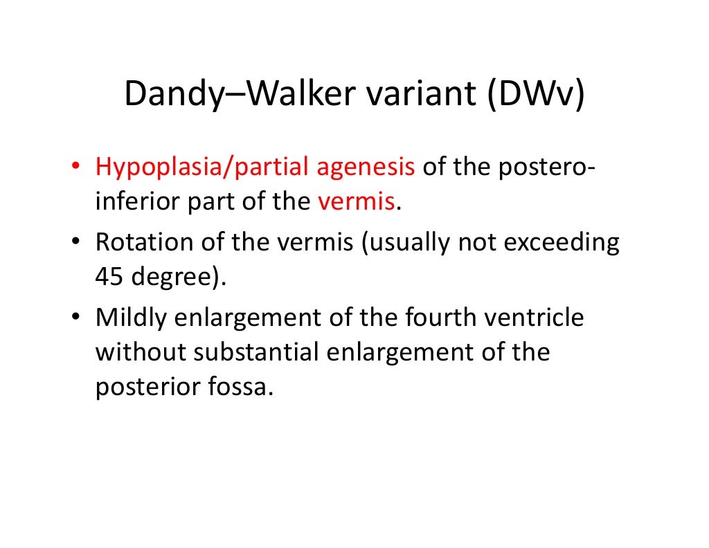 Dandy walker malformation - Hội chứng Dandy Walker