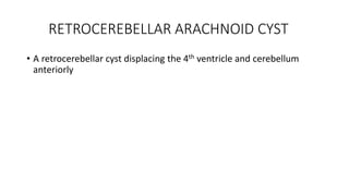 DANDYWALKER MALFORMATION | PDF
