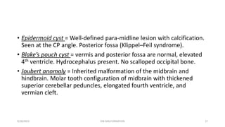 DANDYWALKER MALFORMATION | PDF