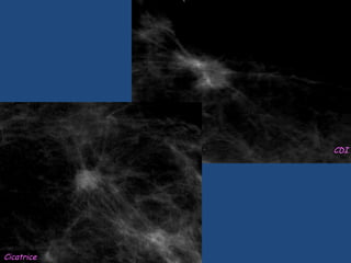 Danese, imaging della mammella | PPT