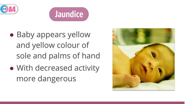 Danger signs in newborn by Dr. Lavanya, Pediatrician | PPTX