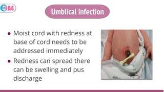 Danger signs in newborn by Dr. Lavanya, Pediatrician | PPTX