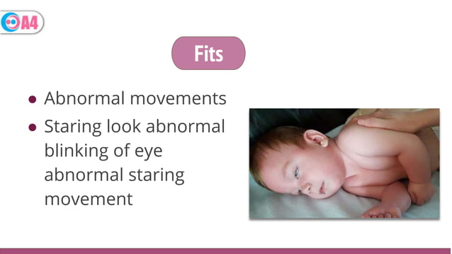 Danger signs in newborn by Dr. Lavanya, Pediatrician | PPTX
