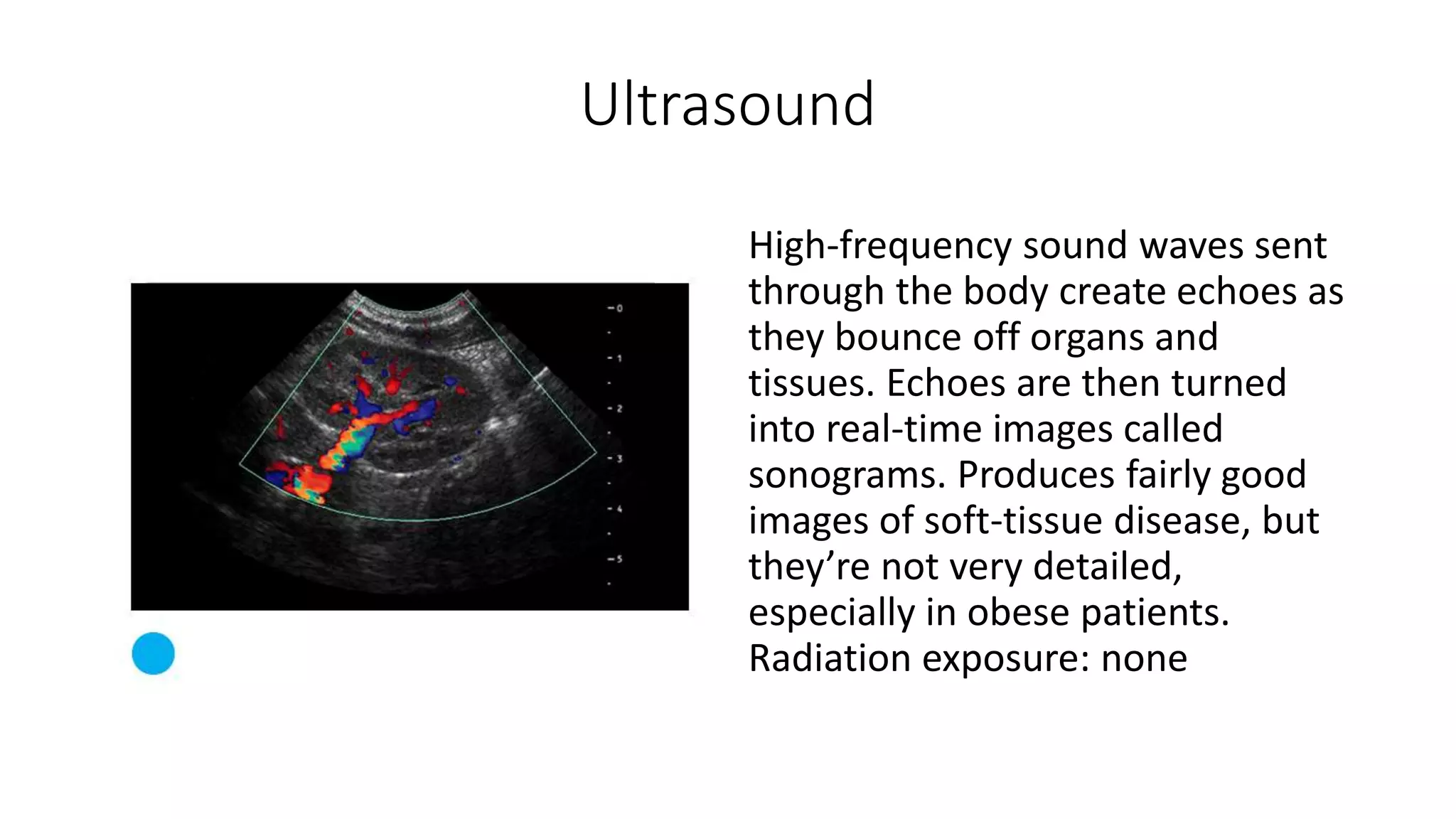 Dangers of ct scans and x rays | PPTX