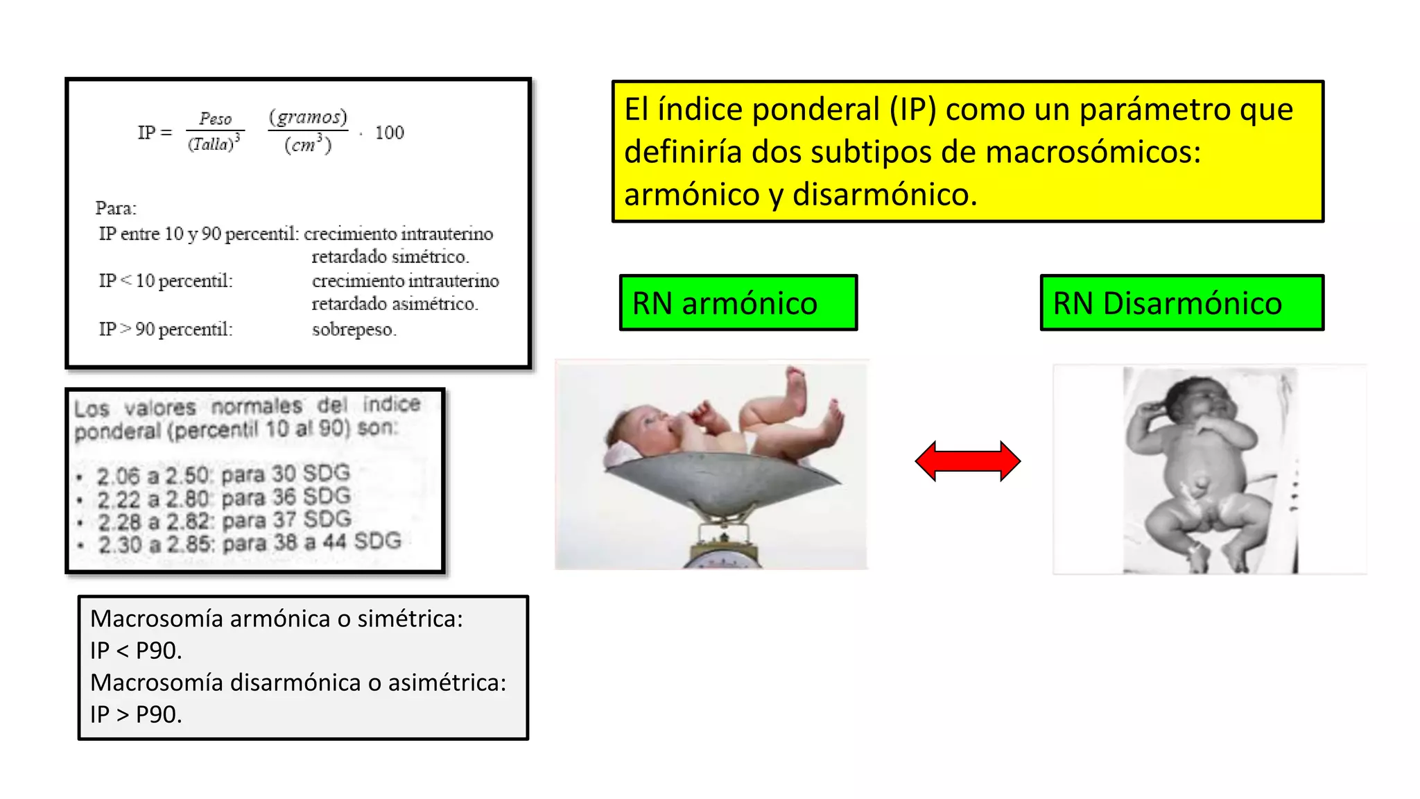 MACROSOMIA FETAL | PPTX