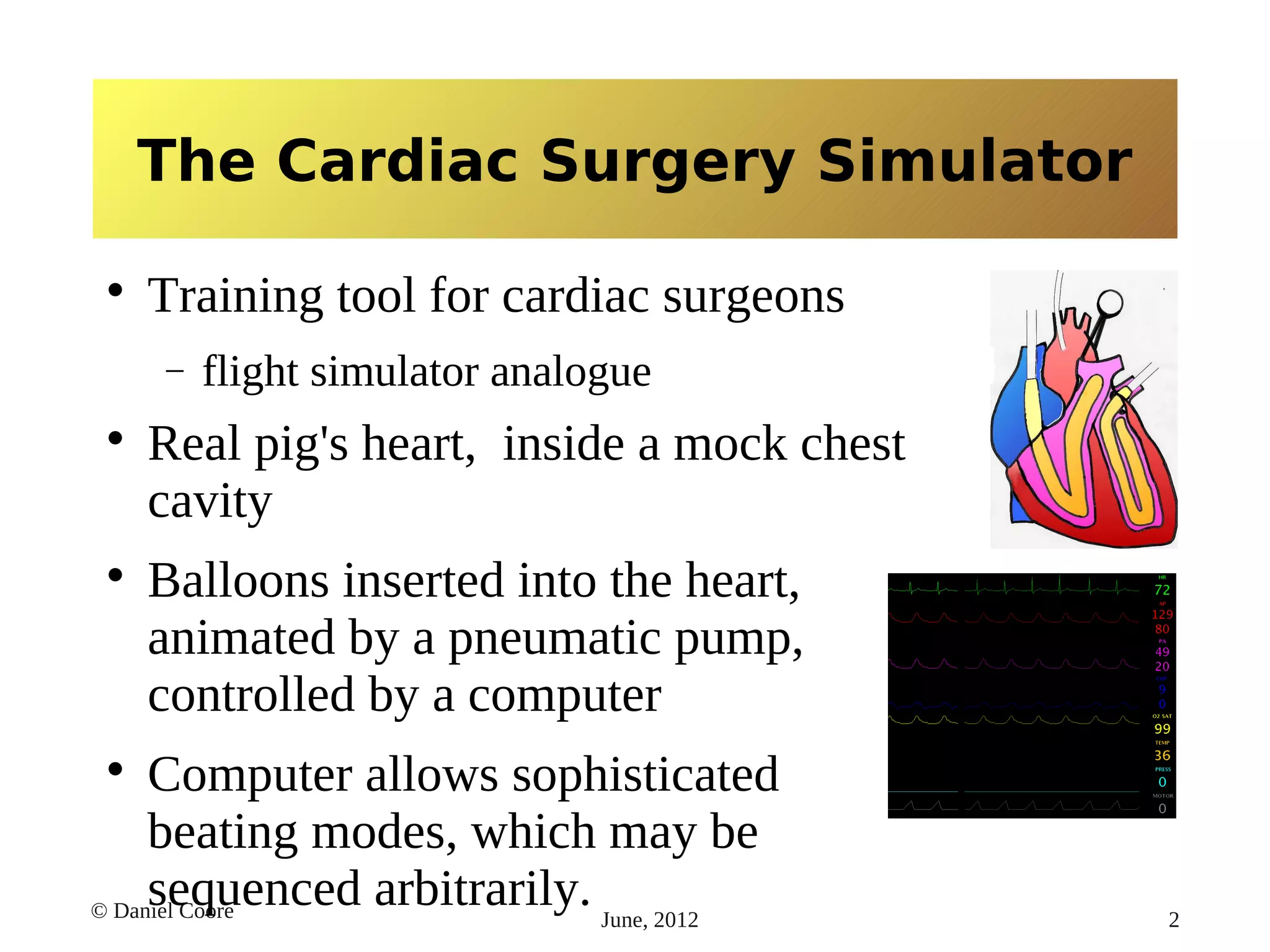 Jamaican Technology Impacting the World: The story of the UWI cardiac ...