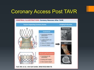 danielle-deady---10-tavr-talk.pptx