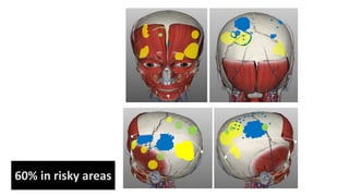 Ancient Trepanation & Brain Surgery in the Andes | PDF