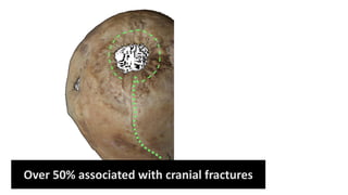 Ancient Trepanation & Brain Surgery in the Andes | PDF