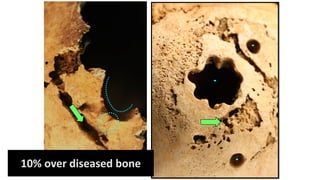 Ancient Trepanation & Brain Surgery in the Andes | PDF