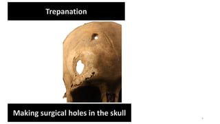 Ancient Trepanation & Brain Surgery in the Andes | PDF