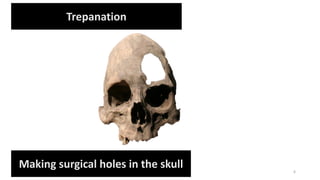 Ancient Trepanation & Brain Surgery in the Andes | PDF