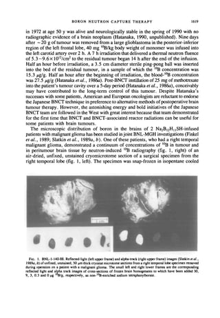 Daniel n. slatkin a history of boron neutron capture therapy of brain ...