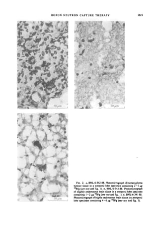 Daniel n. slatkin a history of boron neutron capture therapy of brain ...