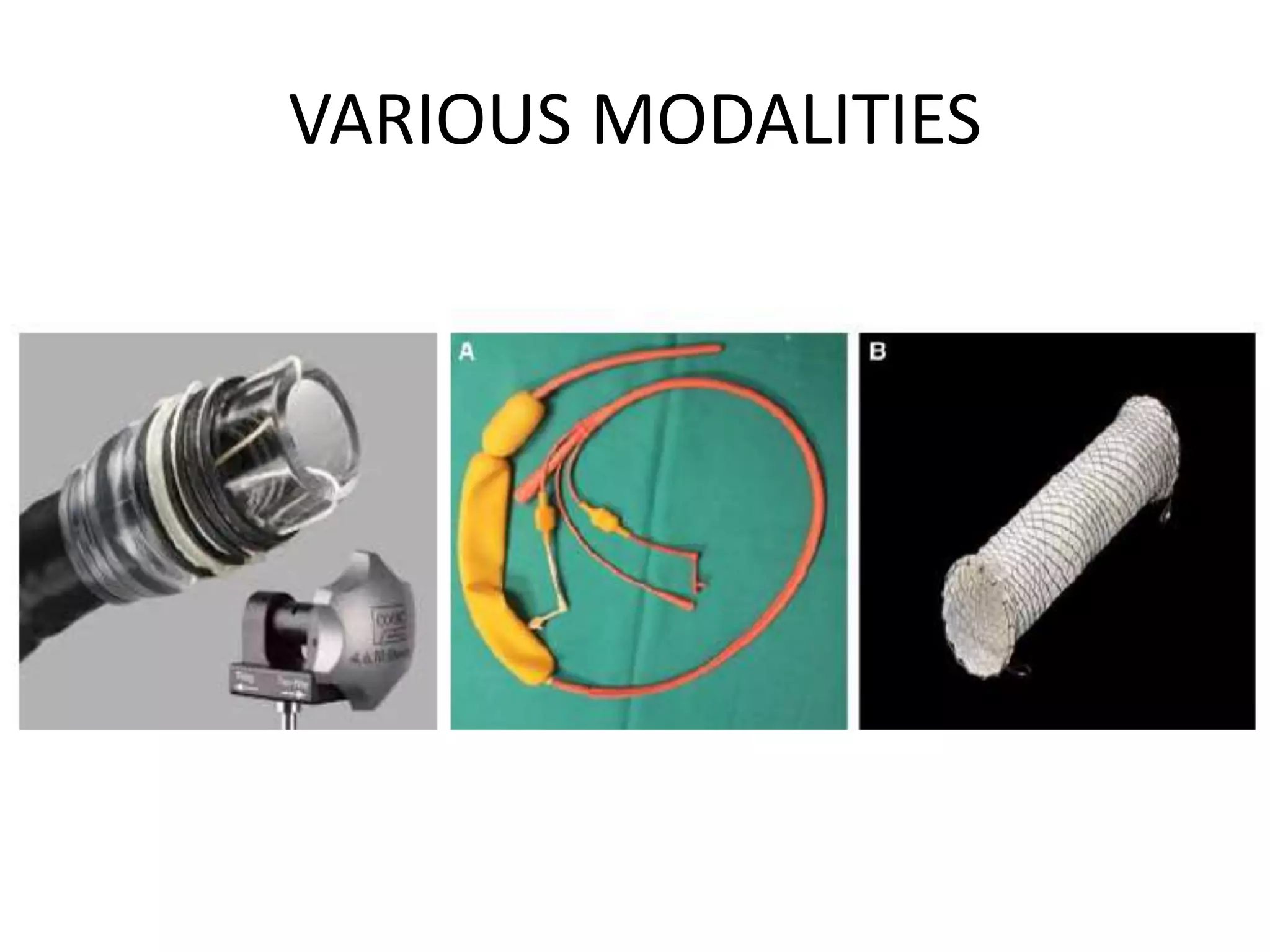 Ella Danis stent | PPTX | Digestive Disorders | Diseases and Conditions