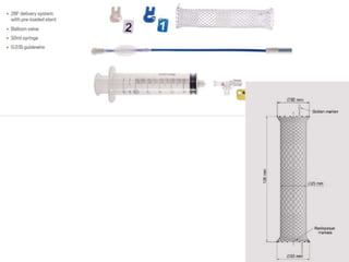 Ella Danis stent | PPTX | Digestive Disorders | Diseases and Conditions
