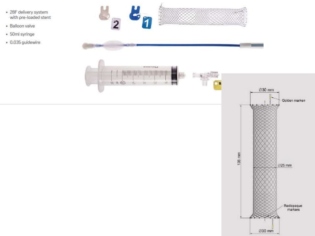 Ella Danis stent | PPTX | Digestive Disorders | Diseases and Conditions