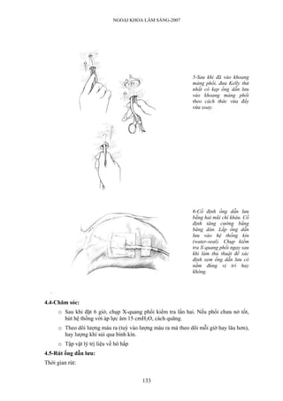 Dan luu | PDF