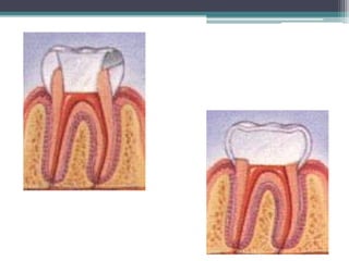 DANTAGATA ROGAH AND TEETH ANATOMY WITH AYURVEDIC DANTAGAT ROGA | PPTX