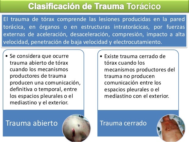 trauma torax