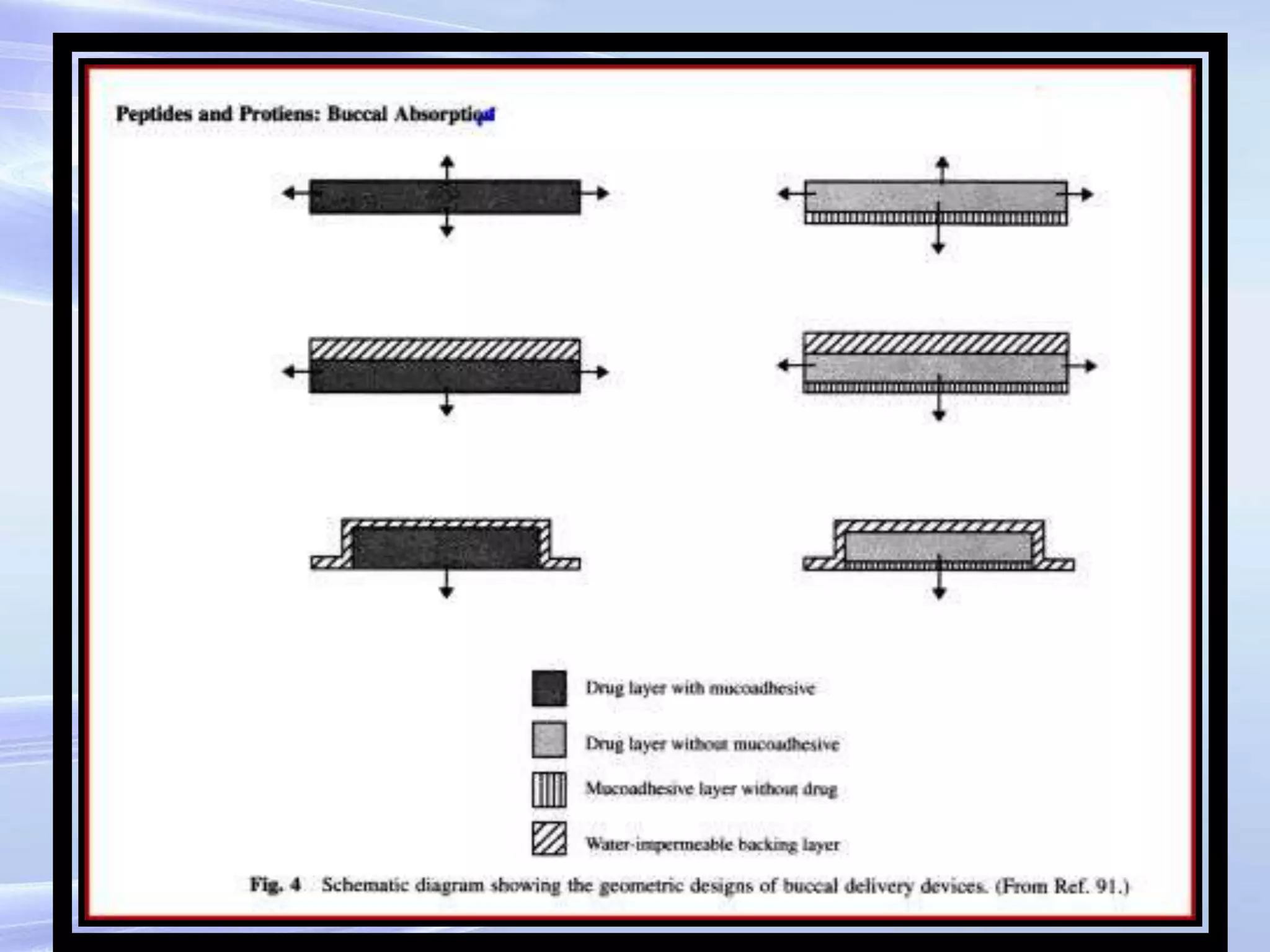 buccal drug delivery system | PPTX