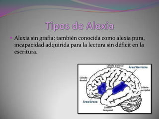 Daño cerebral, afasia, alexia, agrafia | PPTX