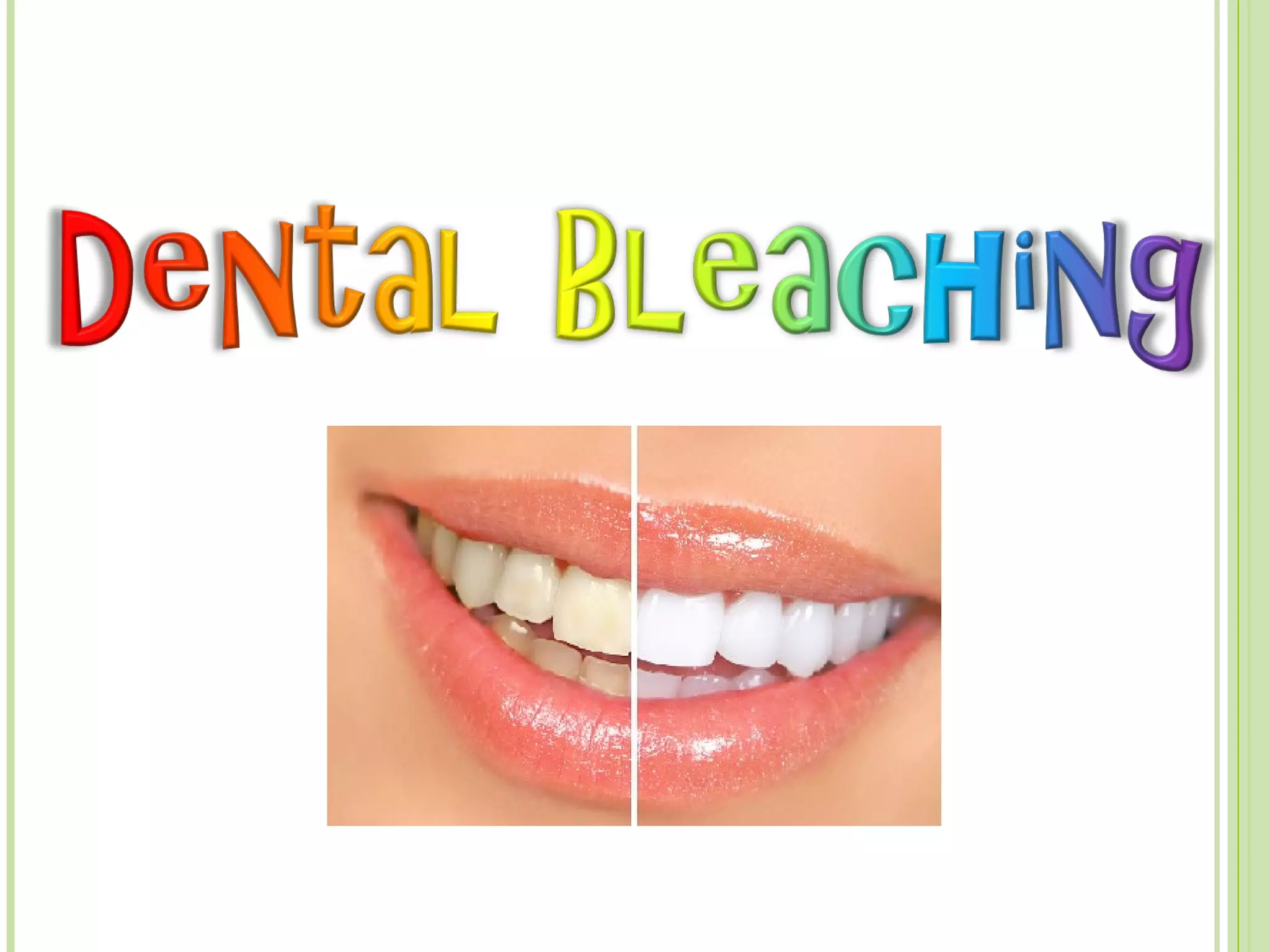 Dental Bleaching | PPT
