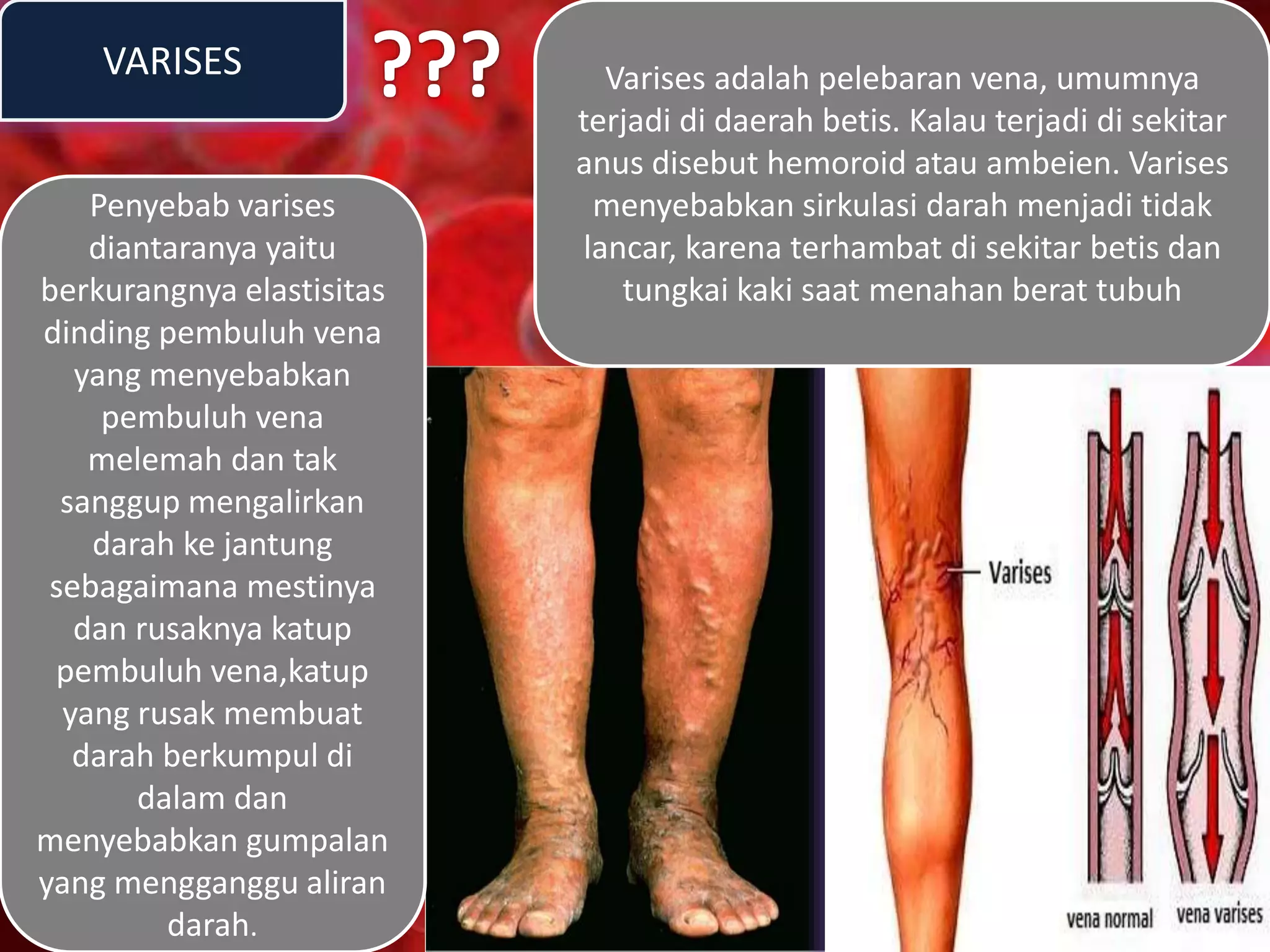 Jaringan Darah (Blood Tissue) | PPTX