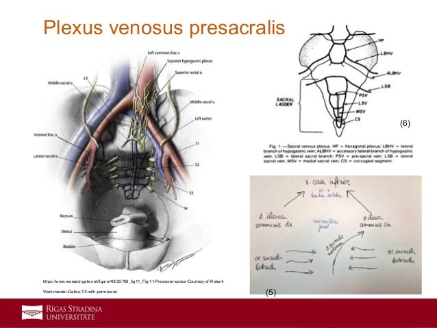Presacral venous plexus bleeding in patients with pelvic fractures