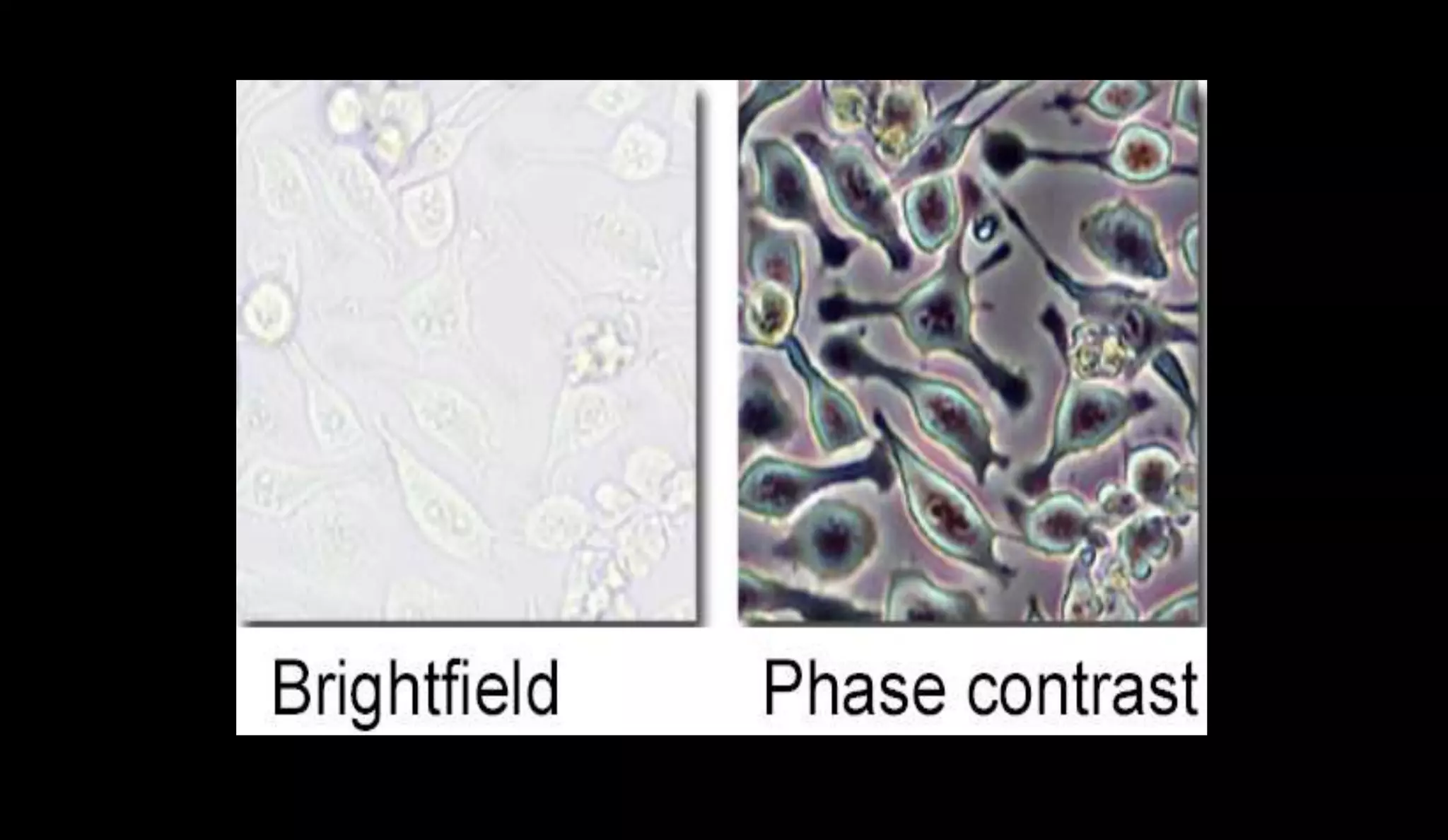 Dark field and Phase Contrast Microscope | PPTX