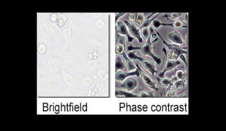 Dark field and Phase Contrast Microscope | PPTX