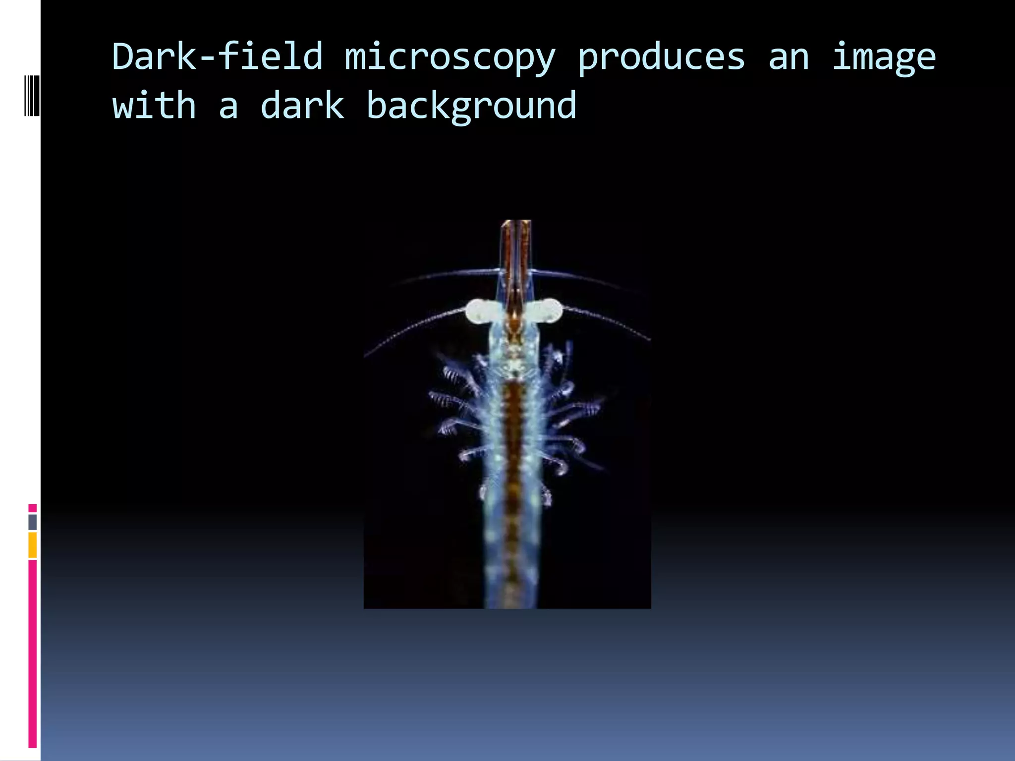 Dark field microscope | PPTX