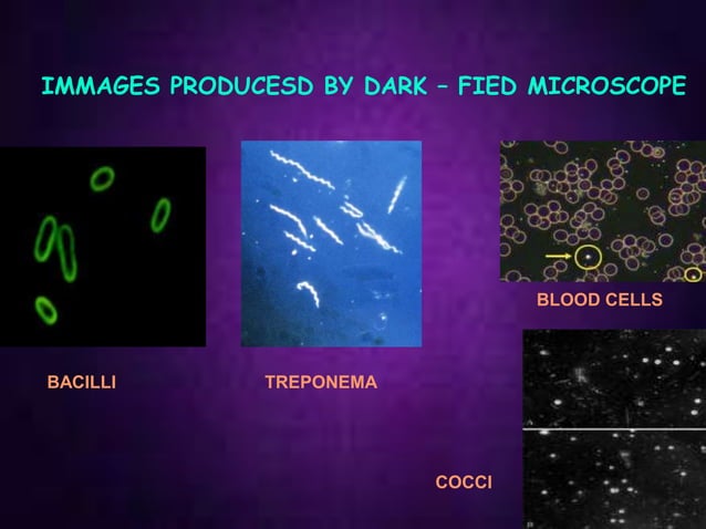 darkfield microscope.ppt