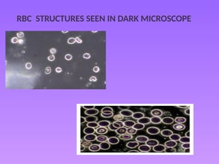 DARKFIELD MICROSCOPE presentation including all | PPTX