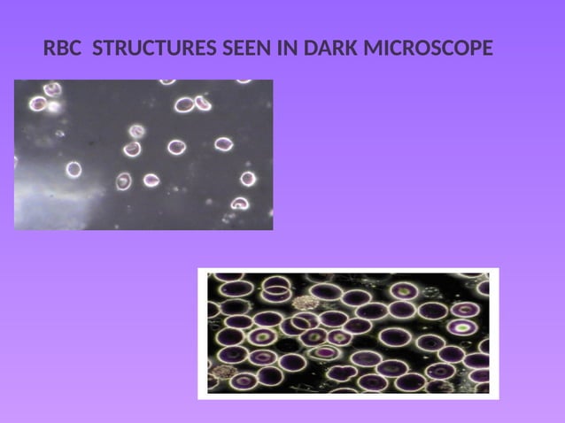 DARKFIELD MICROSCOPE presentation including all | PPTX