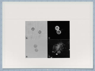 Dark field microscopy | PPTX
