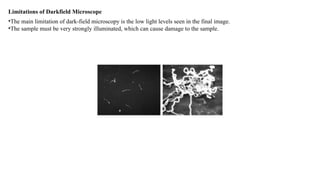 Darkfield microscopy -work and principle | PPTX