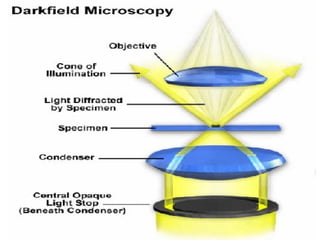 Dark field microscopy (1) By Ehtisham Ul Haq | PPT