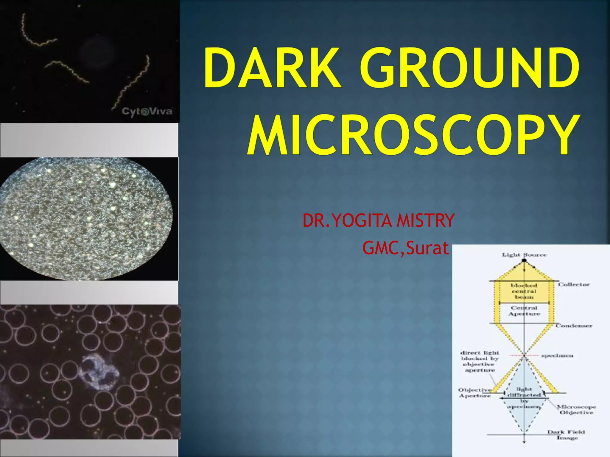 Dark ground microscopy | PPT