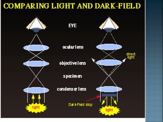 Dark ground microscopy | PPT