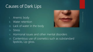 Dark lips & its treatment | PPTX | Skin and Dermatology | Diseases and ...
