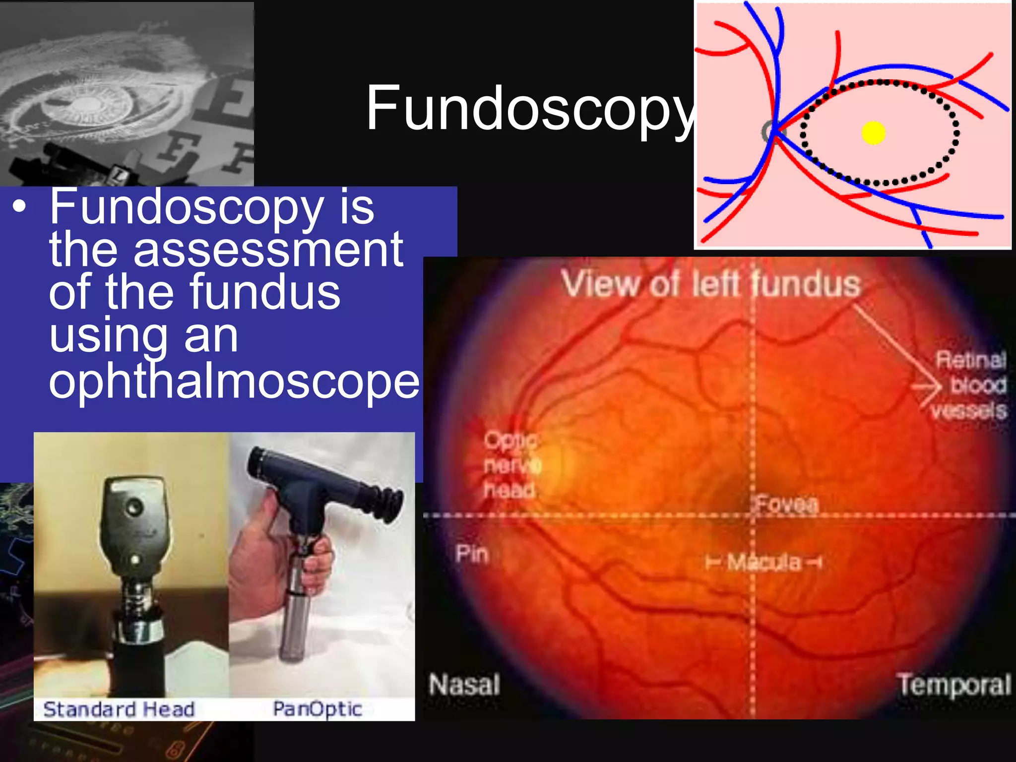 Dark room tests in ophthalmology | PPTX