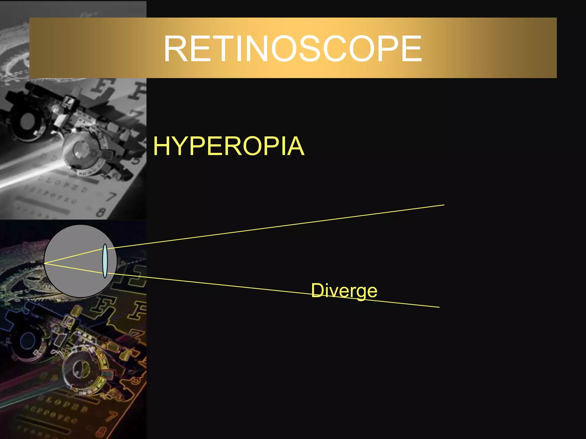Dark room tests in ophthalmology | PPTX