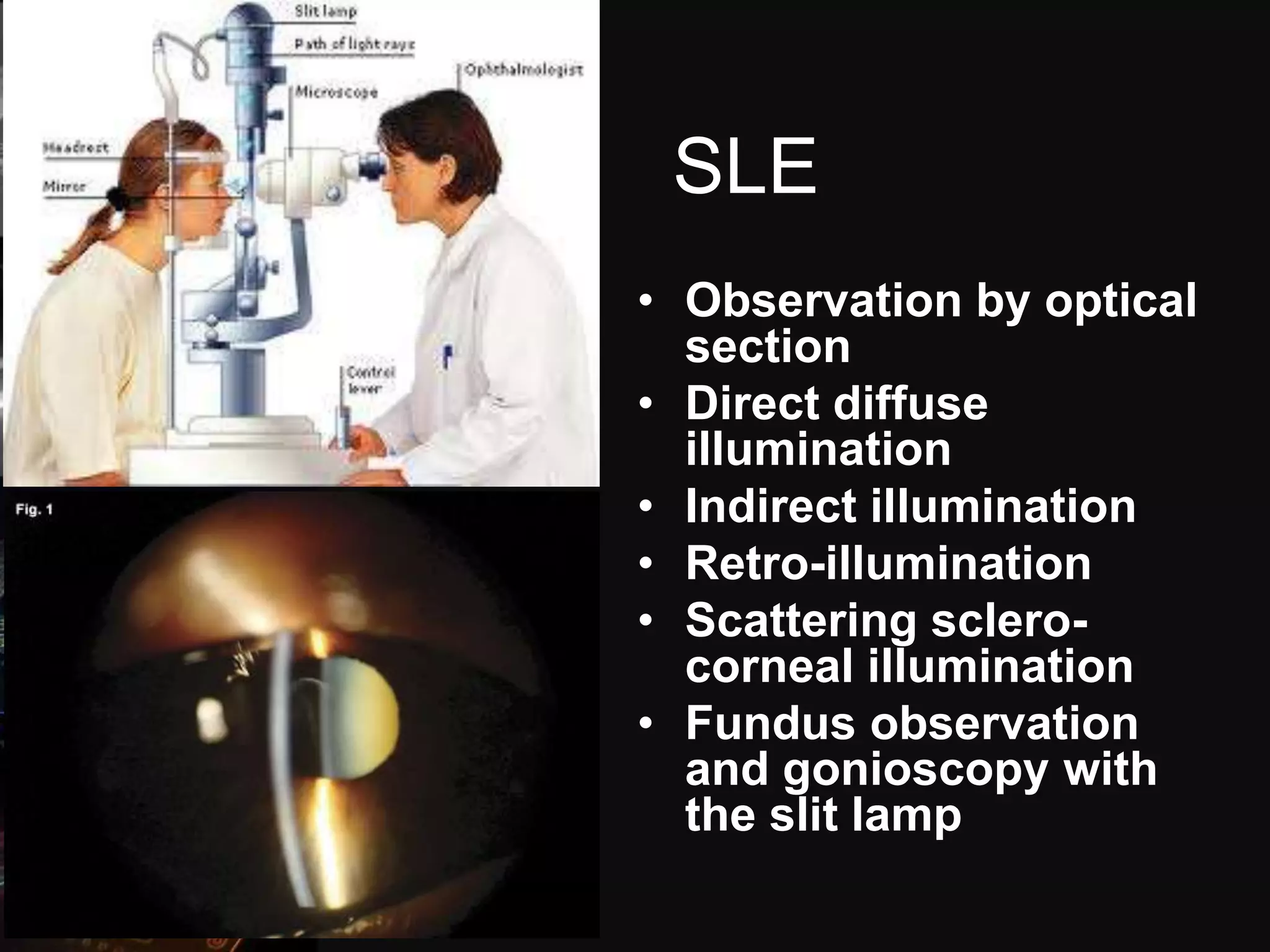 Dark room tests in ophthalmology | PPTX