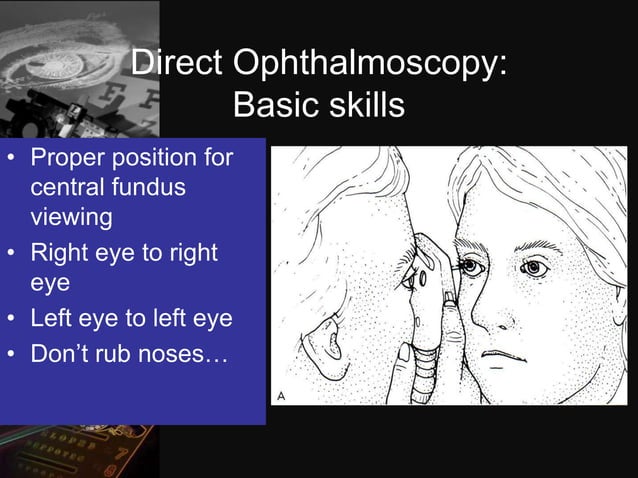 Dark room tests in ophthalmology | PPTX