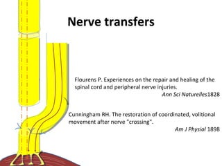 Περιφερικές Νευρομεταφορές για βλάβες του Ωλενίου Νεύρου- Distal Nerve transfers for Ulnar n ...