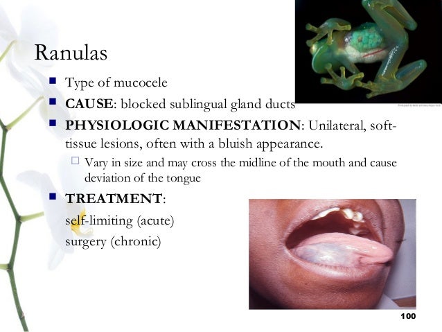 salivary gland and saliva darpan