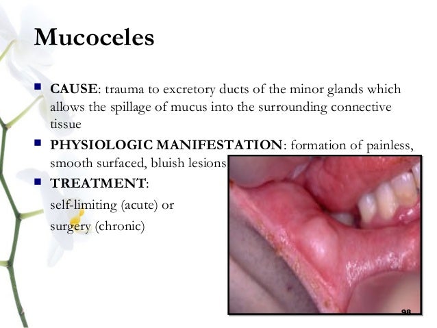 salivary gland and saliva darpan