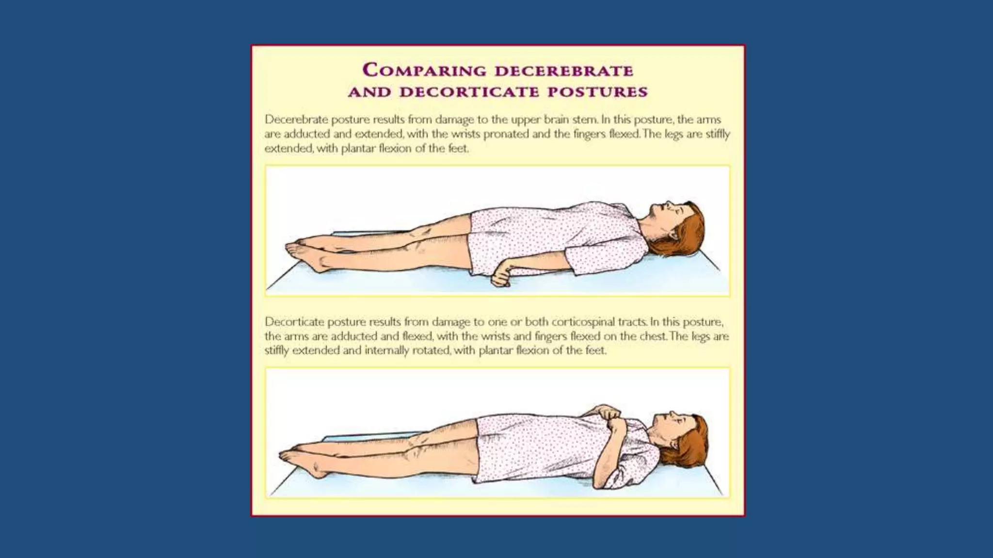 How to perform a neurological exam on a tbi patient | PPTX