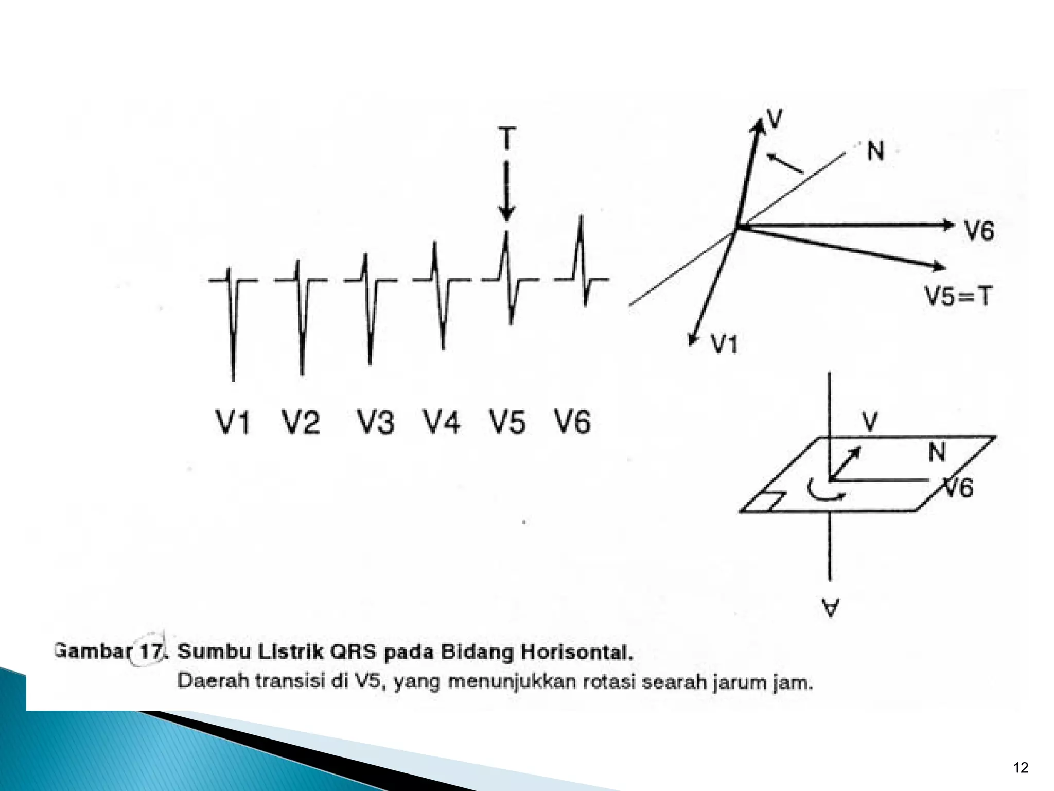 Dasar dasar ekg fix | PPT